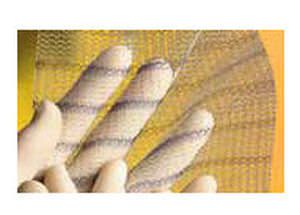 Health Management and Leadership Portal | Abdominal hernia prosthesis ...