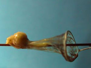 Health Management and Leadership Portal | Embolic protection system ...