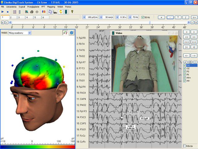 Health Management and Leadership Portal | EEG mapping system EEG ... Health Management and Leadership Portal | EEG mapping system EEG ...