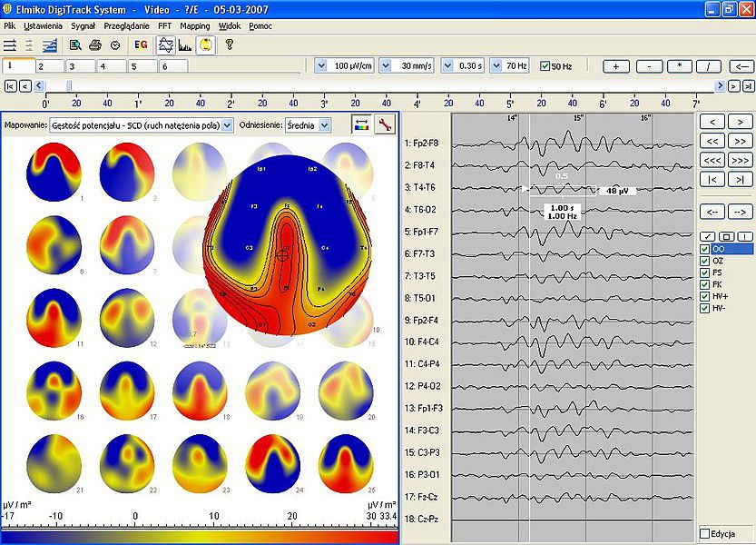 Health Management and Leadership Portal | EEG mapping system EEG ... Health Management and Leadership Portal | EEG mapping system EEG ...
