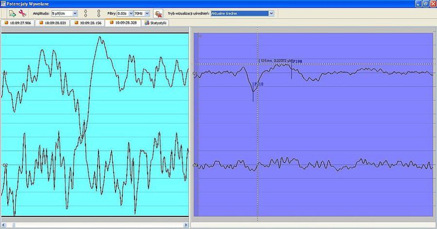 Health Management and Leadership Portal | EEG mapping system EEG ...