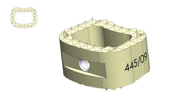 Health Management and Leadership Portal | Lumbar interbody fusion cage ...