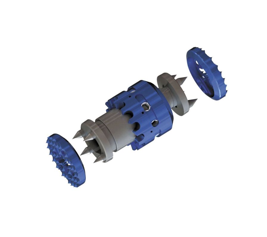 Health Management and Leadership Portal | Lumbar interbody fusion cage ...