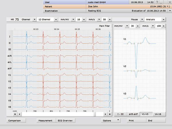 Health Management and Leadership Portal | Tabletop spirometer custo vit ...