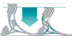 Health Management and Leadership Portal | Foot prosthesis (lower ...