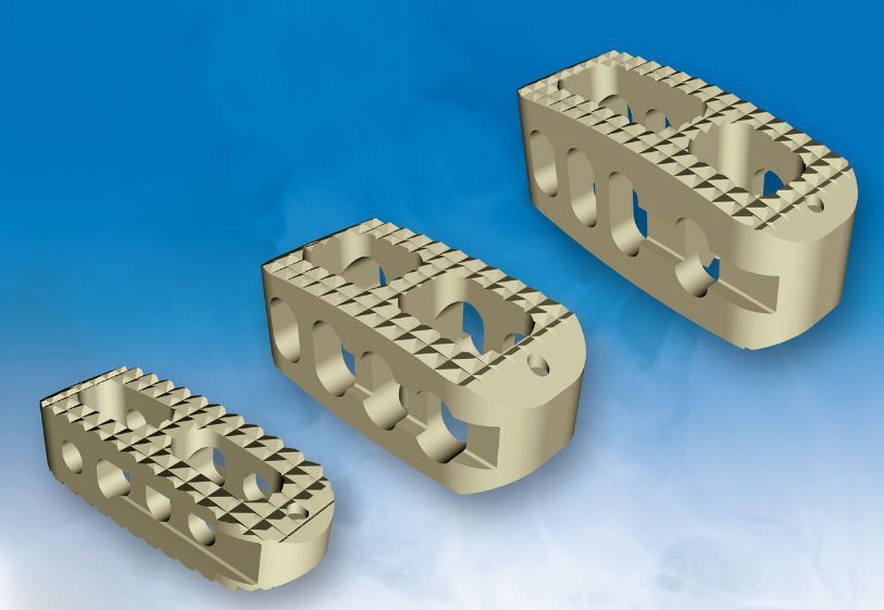 Health Management and Leadership Portal | Cervical interbody fusion ...