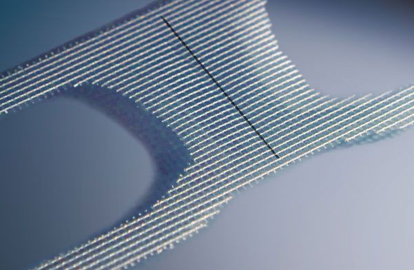 Health Management and Leadership Portal | Abdominal hernia prosthesis ...