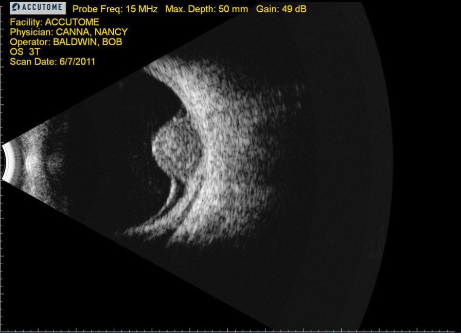 Health Management and Leadership Portal | Pachymeter (ophthalmic ...