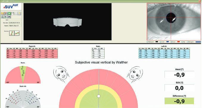 Health Management and Leadership Portal | Videonystagmography system ...