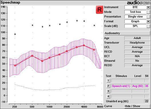 Health Management and Leadership Portal | Fitting analyzer (hearing aid ...