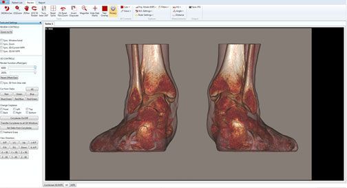 Health Management and Leadership Portal | X-ray scanner (tomography ...