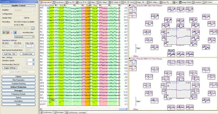 Health Management and Leadership Portal | ERP amplifier / EEG / 128 ...