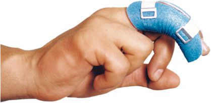 Health Management and Leadership Portal | Finger splint (orthopedic ...
