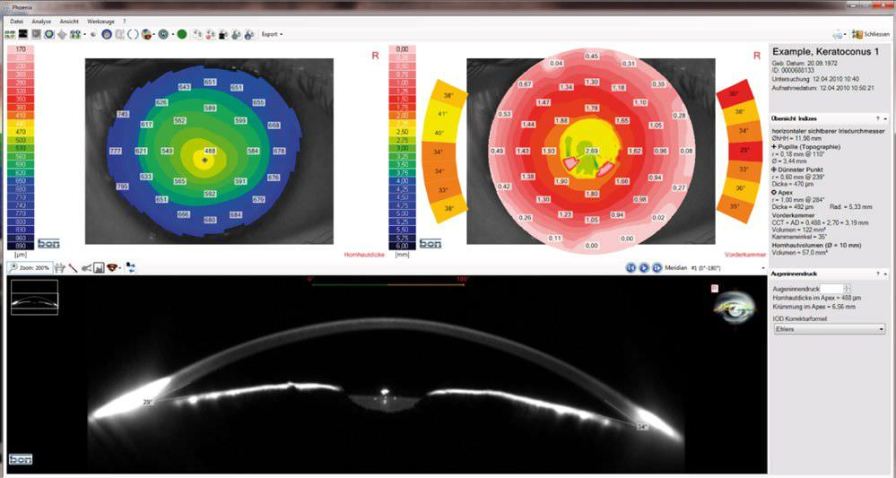 Health Management and Leadership Portal | Scheimpflug camera ...