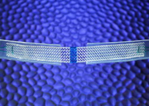 Health Management and Leadership Portal | Urinary incontinence mesh ...