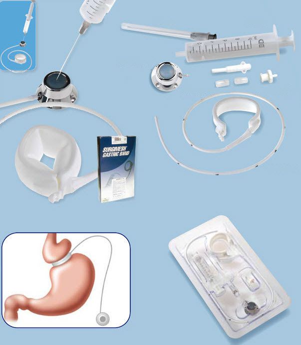 Health Management and Leadership Portal | Abdominal hernia prosthesis ...