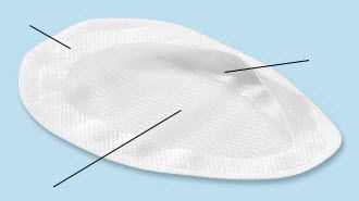 Health Management and Leadership Portal | Umbilical hernia prosthesis ...