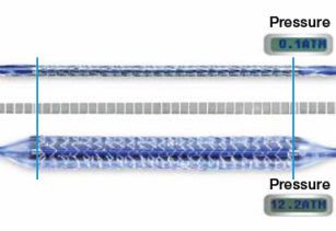 Health Management and Leadership Portal | Coronary stent / metal / bare ...
