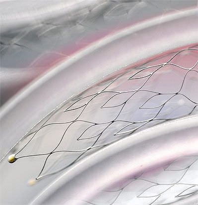 Health Management and Leadership Portal | Stent / embolization coil ...