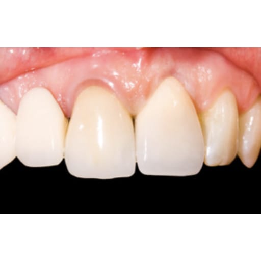 Plantation Dental Care is your dental care provider in Plantation ...