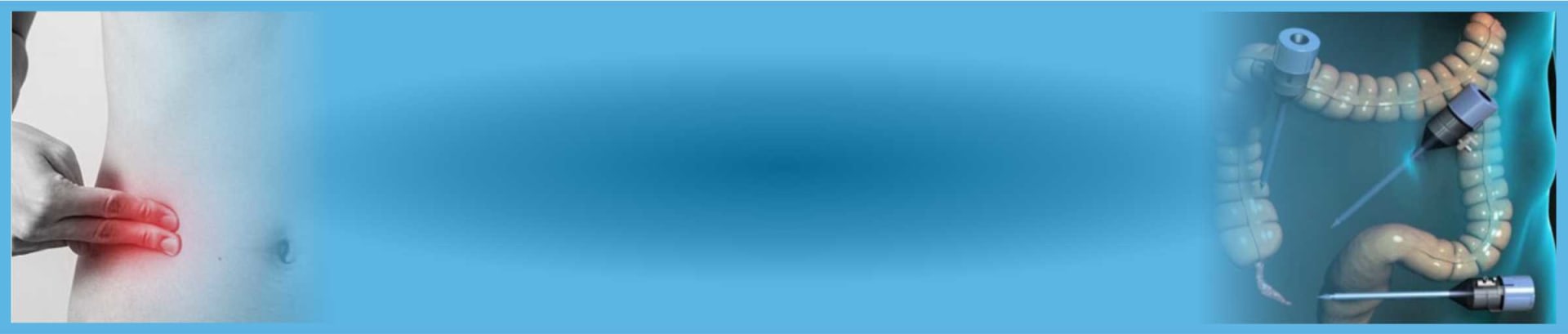 Best Laparoscopic Surgery for Appendix in Varanasi | Heritage Hospital