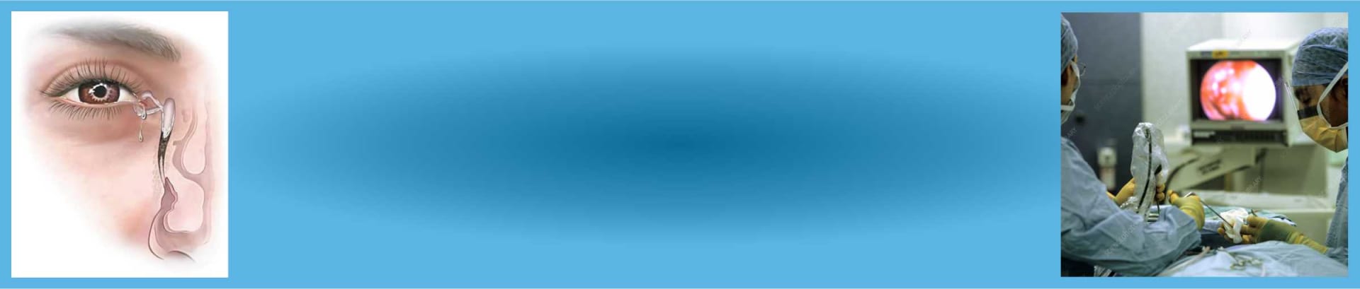 Endoscopic DCR in Varanasi | Heritage Hospital