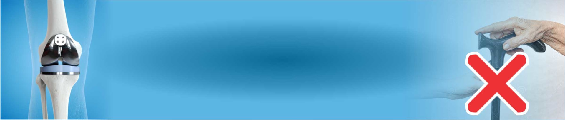 Affordable Knee Replacement Surgery in Varanasi | Heritage Hospitals