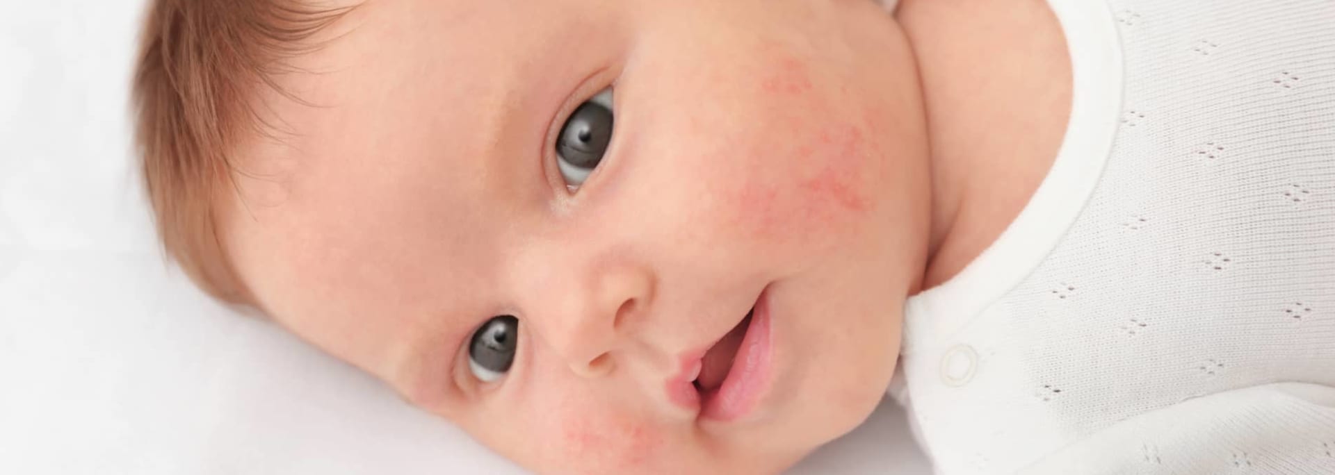 Alergias alimentarias en bebés 🥚 Blog Hero