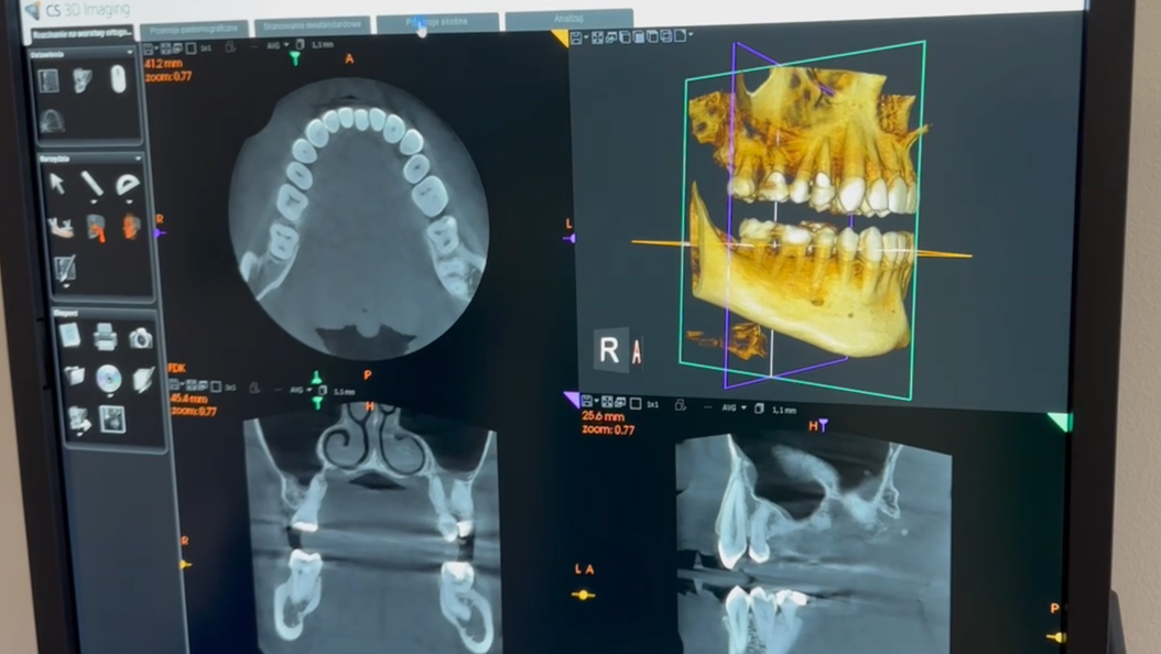 Howicured.org - How to heal and strengthen your teeth to not need a ...