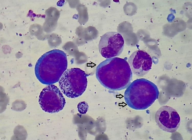 Hematopoiesis - howitreat.in