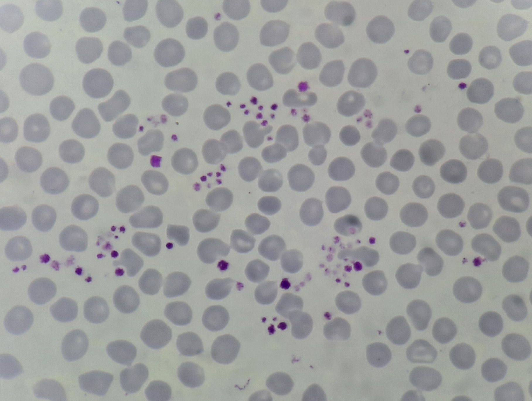 Suspected Bleeding Disorder - howitreat.in