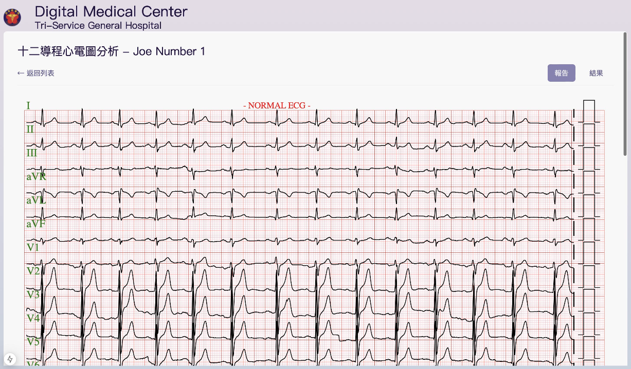 Tri-Service General Hospital: AI ECG Analyzer