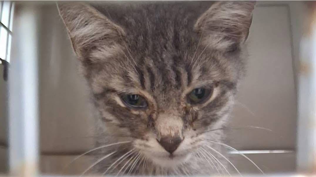Help Ash Receive Surgery
