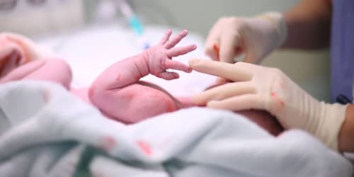 Why Did My Baby Have A Stroke During Birth?