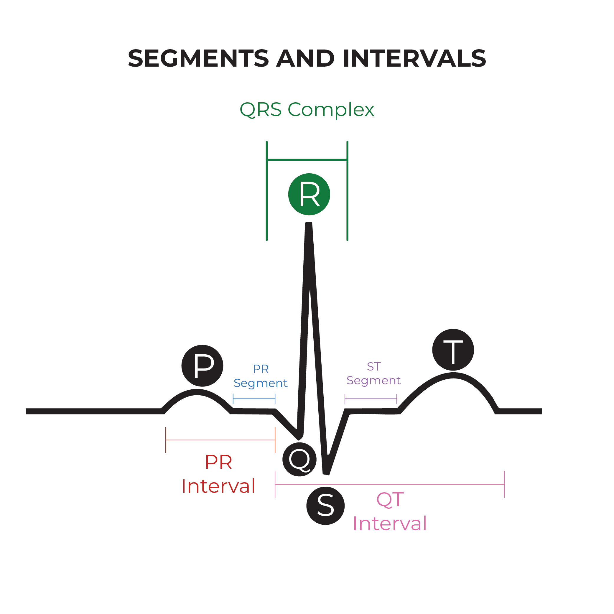 Epilepsy and the heart: Intersecting pathways of neurologic and ...