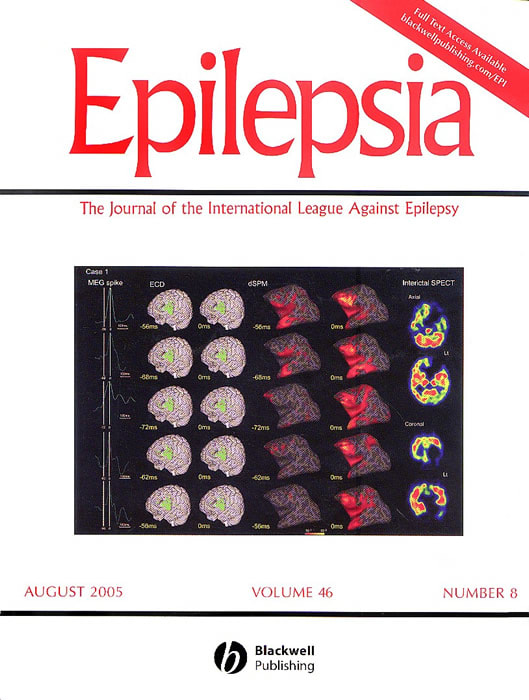 The Cover Design of Epilepsia // International League Against Epilepsy