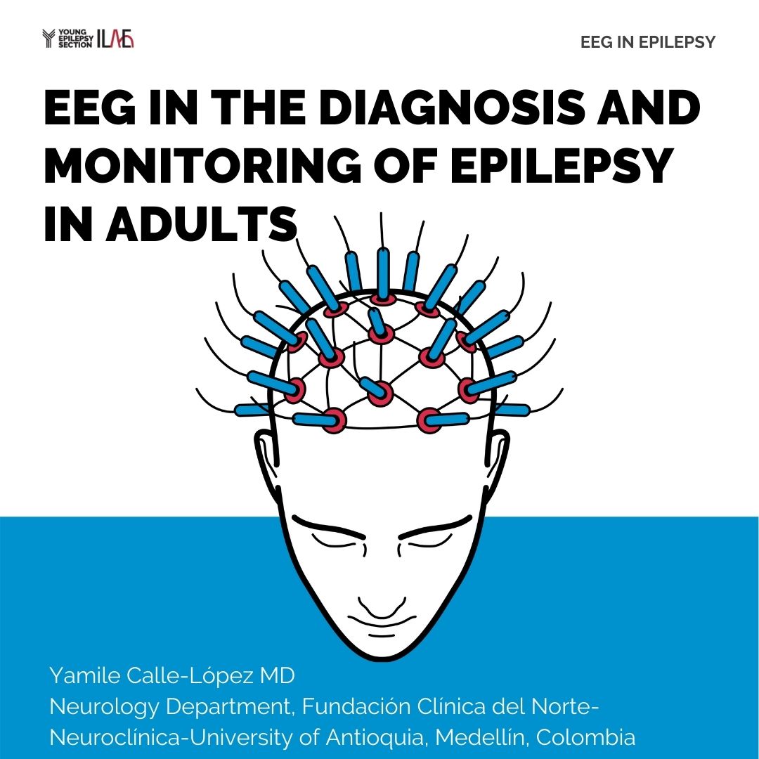 Infographics // International League Against Epilepsy