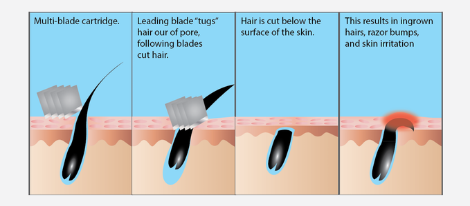 Rockwell Model T Razor & Blades: Shaving Perfected | Indiegogo