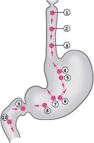 Gastroskopi (EsofagoGastroDuodenoskopi, EGD)