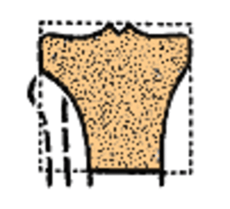 Tibiafraktur, proximal, hos vuxna