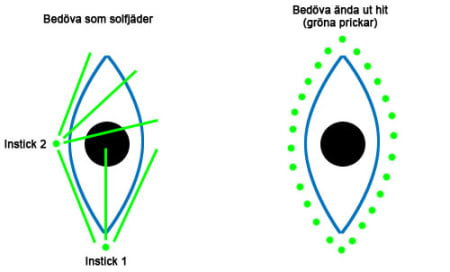 Chirurgia minor – naevus och "knutor"