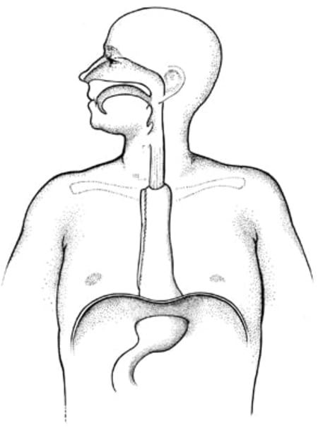Esofaguscancer och kardiacancer