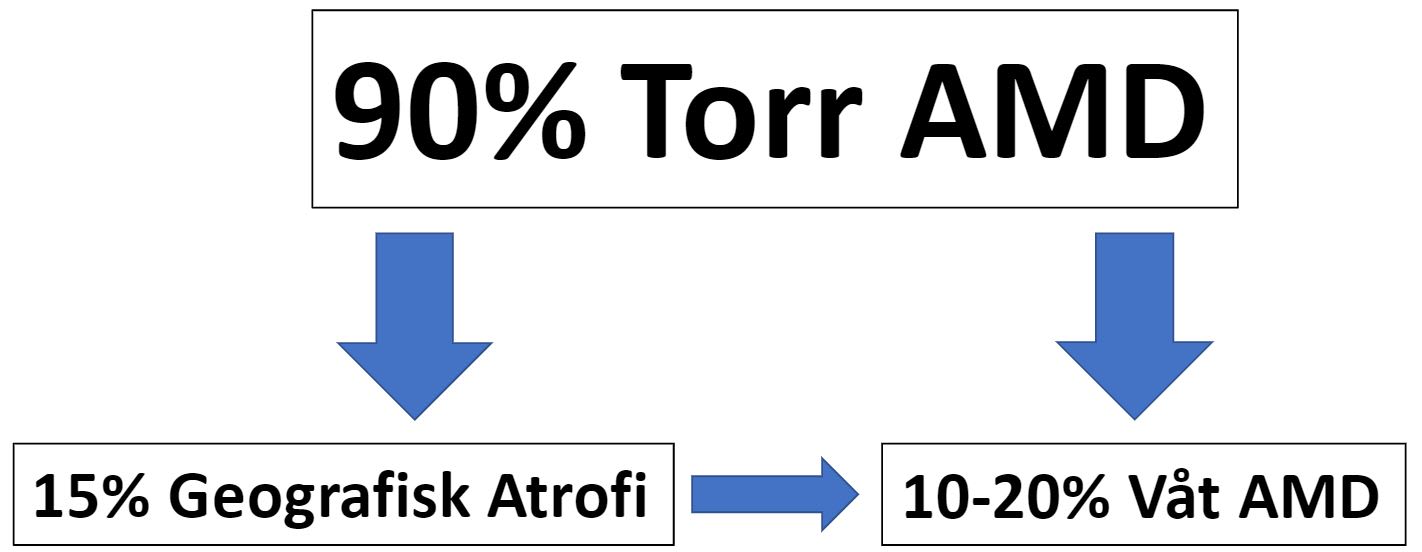 Makuladegeneration, åldersrelaterad (AMD)