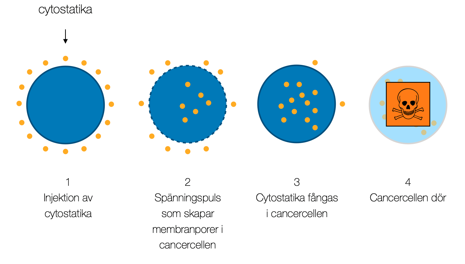 Elektrokemoterapi (EKT)