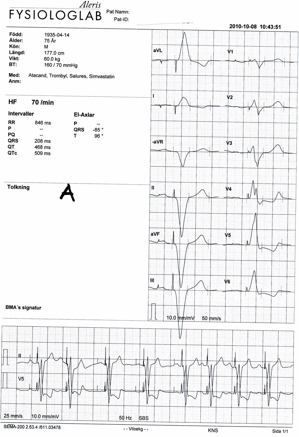 EKG-atlas, övriga tillstånd