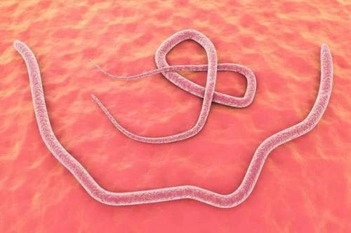 Why Do Roundworms Grow In The Human Body Longevity why-do-roundworms-grow-in-the-human-body-longevity
