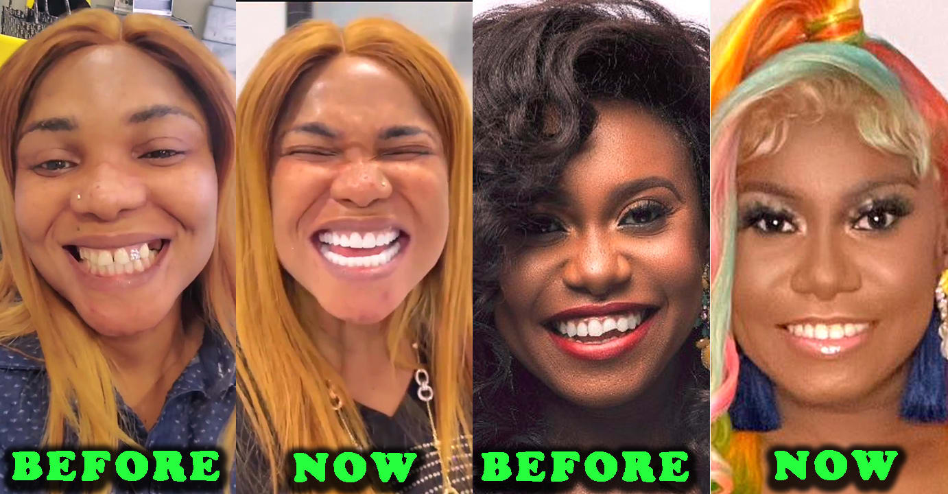 Actresses With Gap Teeth 60 Photos - Moonagedaydream.film