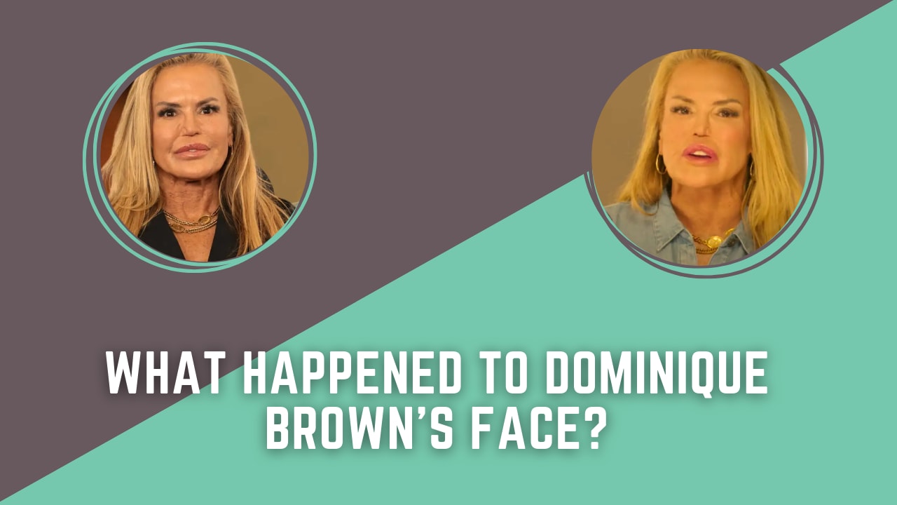 What Happened To Dominique Brown's Face? | Interview