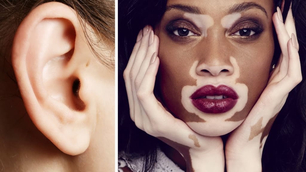 Rare Body Features That Show Just How Incredible the Human Body Is