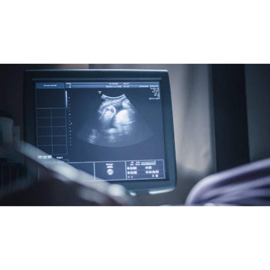 Are Ultrasounds Loud For The Baby